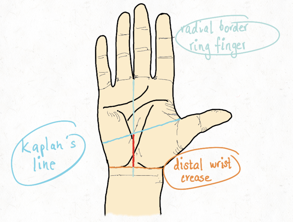 Carpal Tunnel Surgery Course